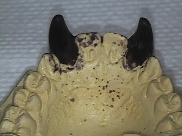 Down in the Mouth: Count Dracula Teeth: Dracula Baby